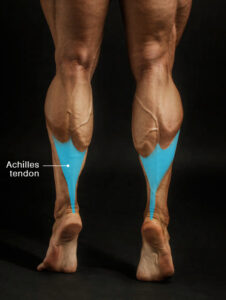 Achilles Tendon: Location, Anatomy, Functions, & Diagram
